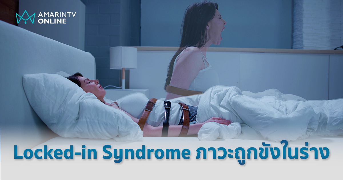 Locked-in Syndrome ภาวะถูกขังในร่าง มีสติรับรู้แต่ขยับตัวไม่ได้